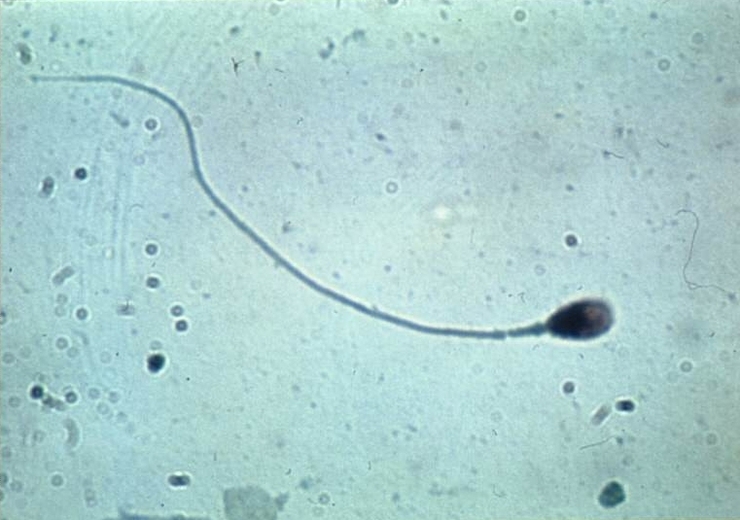 Spermatozoïde Sous Microscope Optique